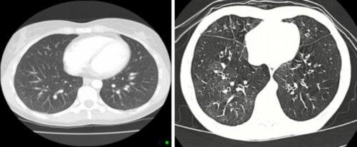 Question: How do the ingredients in e-cigarettes and vaporizers affect ...